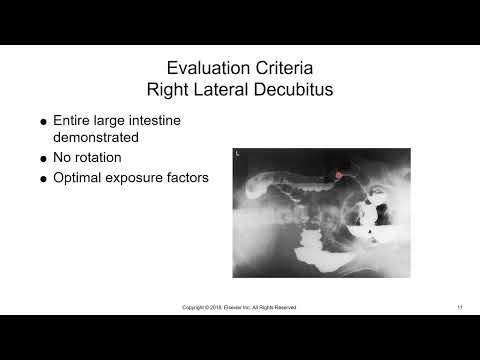 Chapter 13 Double Contrast Enema, Evacuative Proctography, and ...