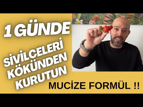 1 Günde Sivilceler Nasıl Geçer ? Sivilceleri Yok Eden Bitkisel Maske