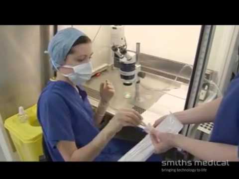 Wallace Smiths medical Embryo transfer catheters - YouTube