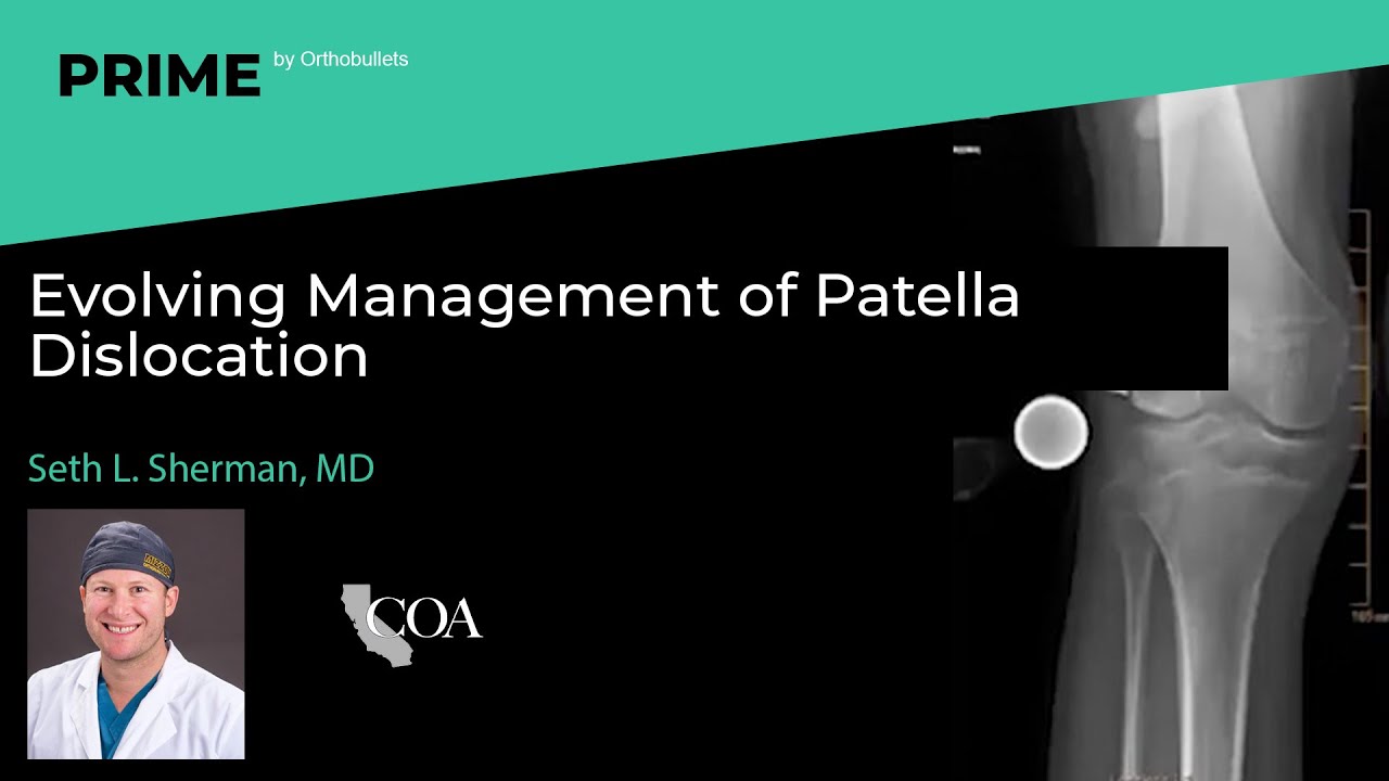 Evolving Management of Patella Dislocation - Seth L. Sherman, MD - YouTube