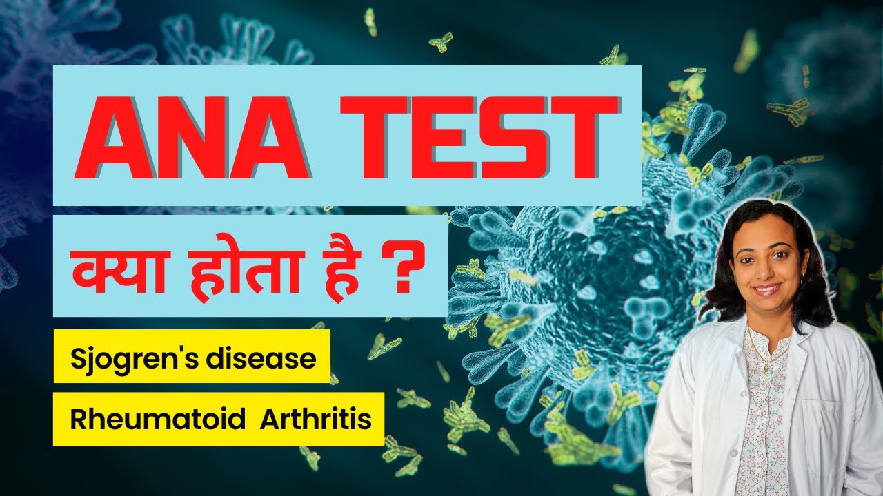 ANA Test क्या होता है, क्यों किया जाता है? | How ANA is test performed ...