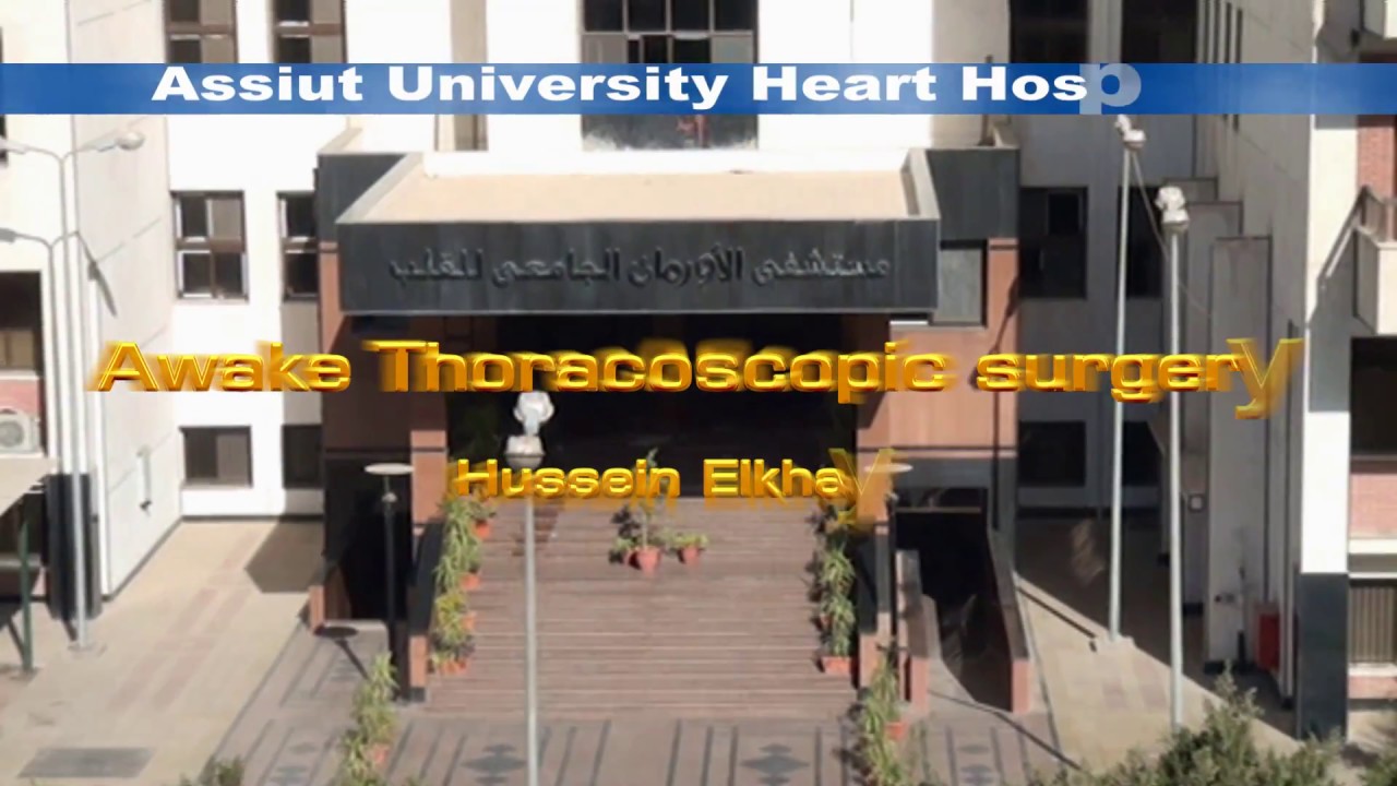 non intubated awake VATS evaculation for clotted hemothorax - YouTube