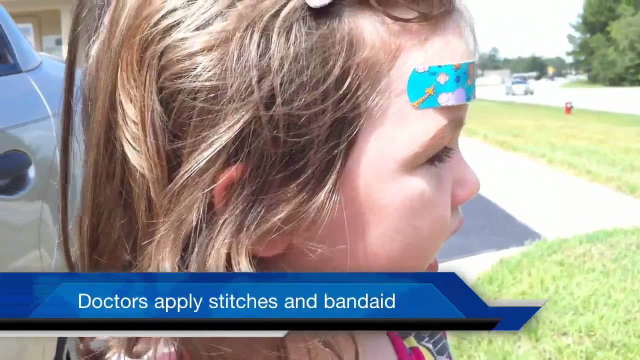Emma gets stitches - YouTube