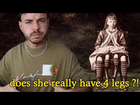 Does she really have 4 legs ?!