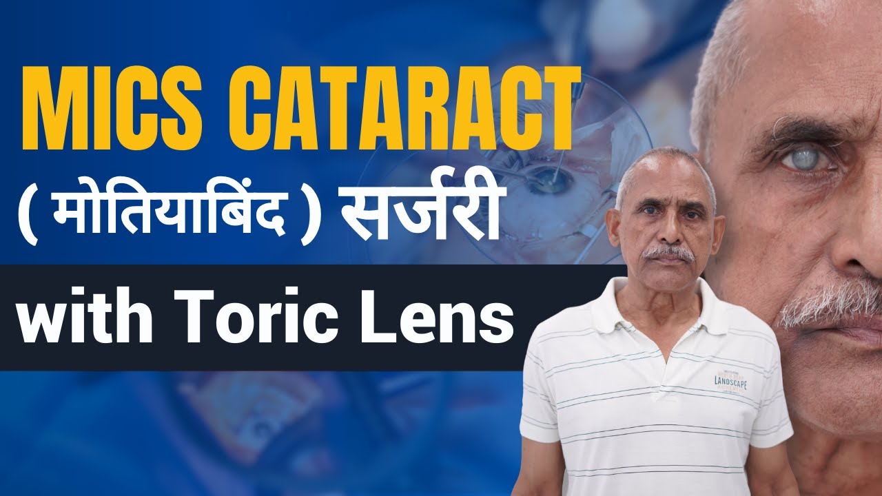 MICS Cataract Surgery With Toric Lens - YouTube