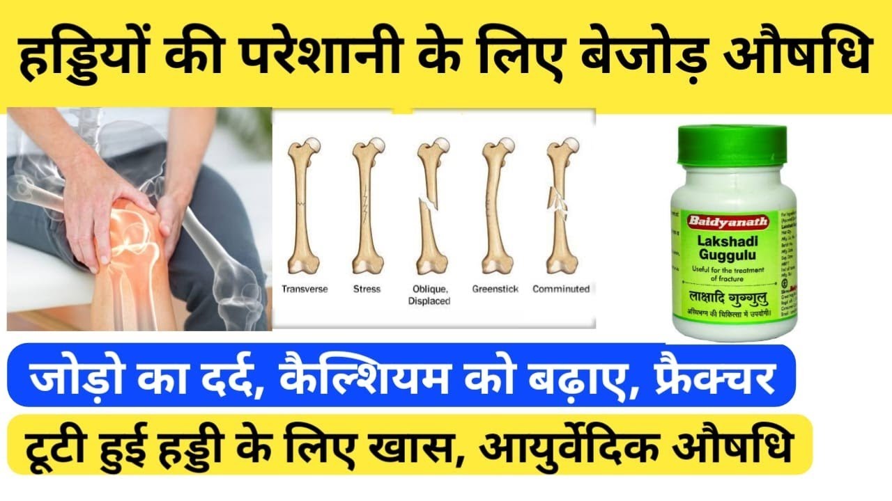 Laxadi Guggulu Benefits Uses in Hindi | Laxadi Guggulu ke fayde in ...