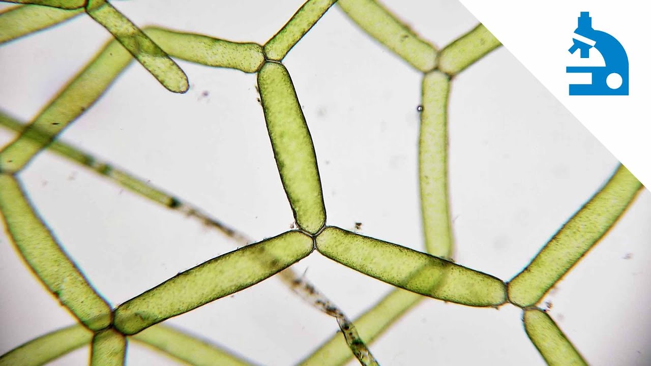 Algae Corner: "What Is It?" - Water Net / Hydrodictyon - YouTube