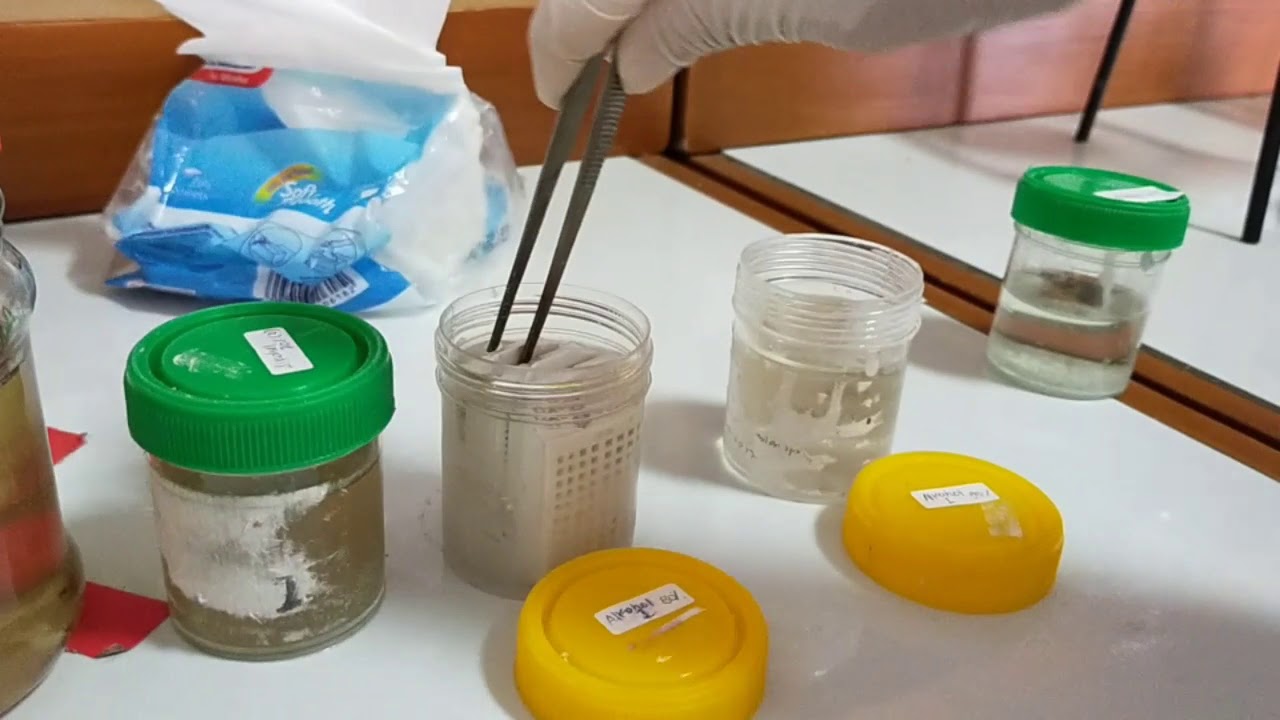 SITOHISTOTEKNOLOGI: Pengambilan Jaringan dan Pematangan Jaringan pada ...