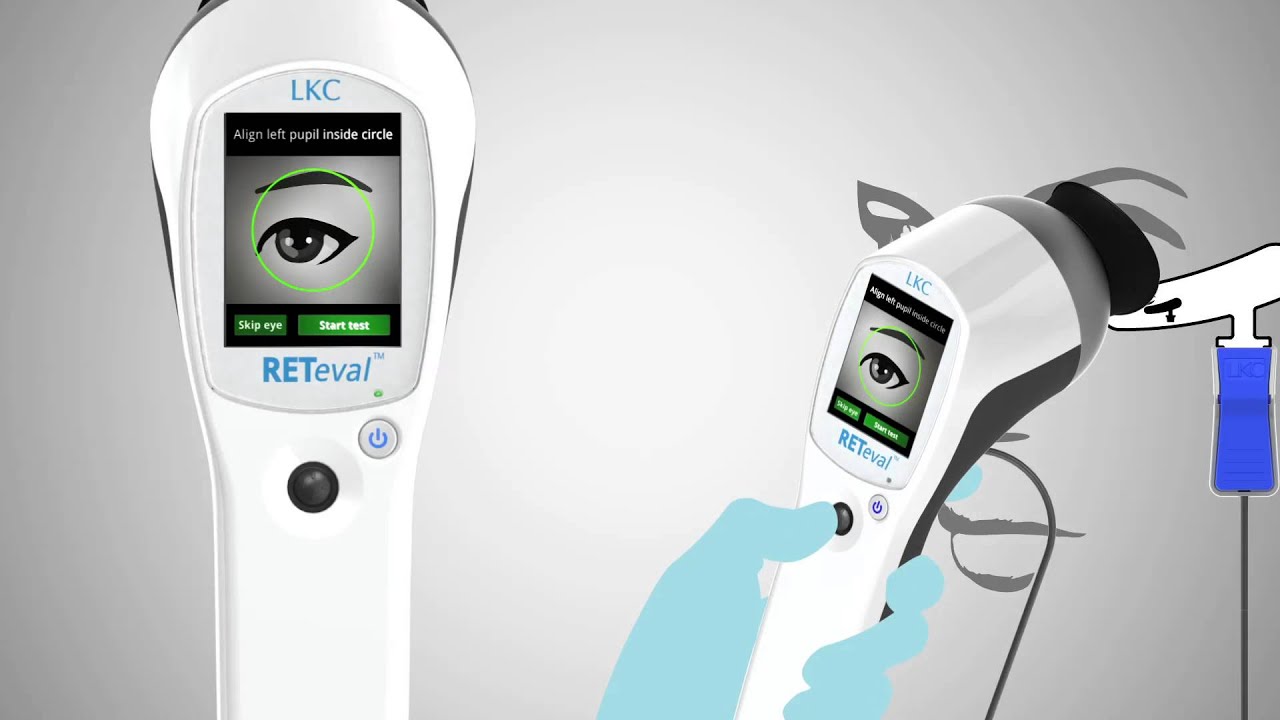 RETeval™ Visual Electrodiagnostic System - YouTube