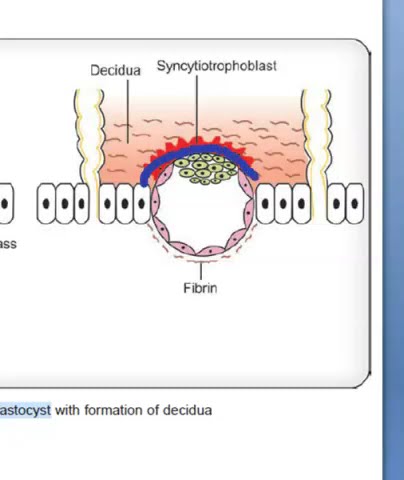 Anatomy Embryology DECIDUA Define Basalis Capsularis Parietalis ...