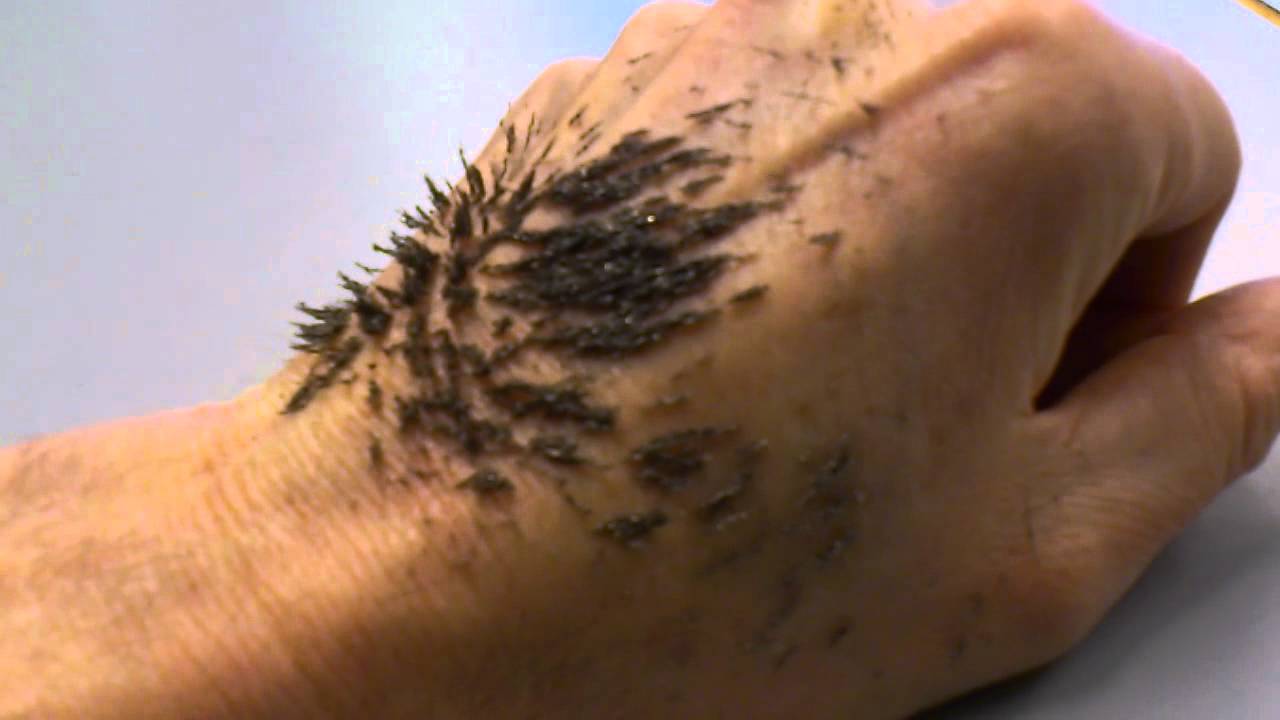 Hairy Hands - Alchetron, The Free Social Encyclopedia