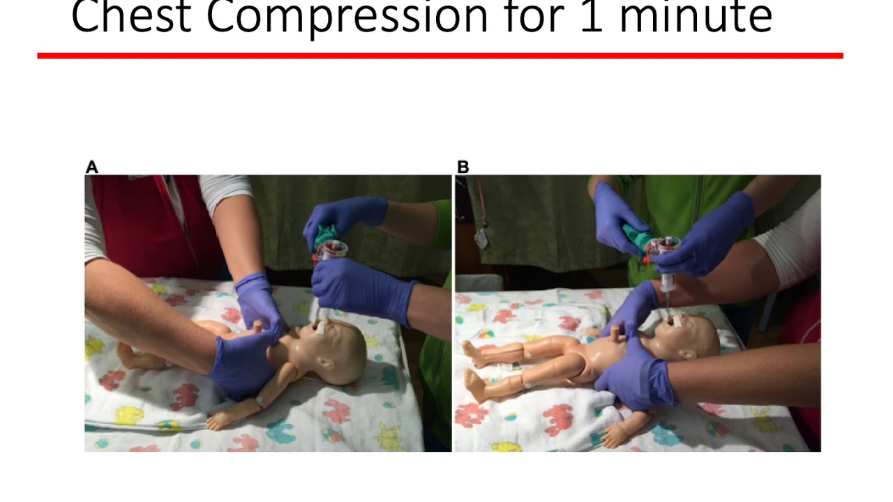 Neonatal Resuscitation 3 - YouTube