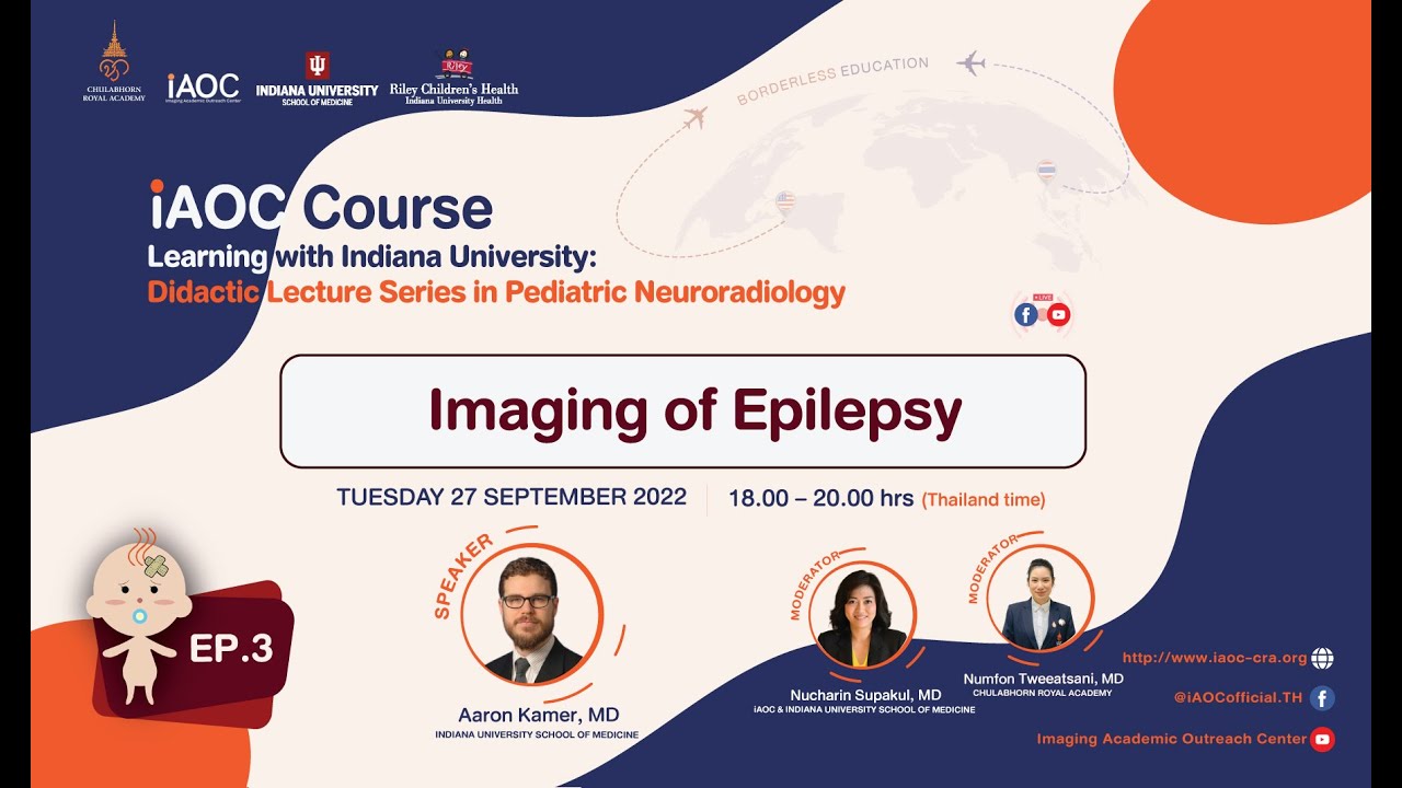EP 3: Imaging of Epilepsy - YouTube