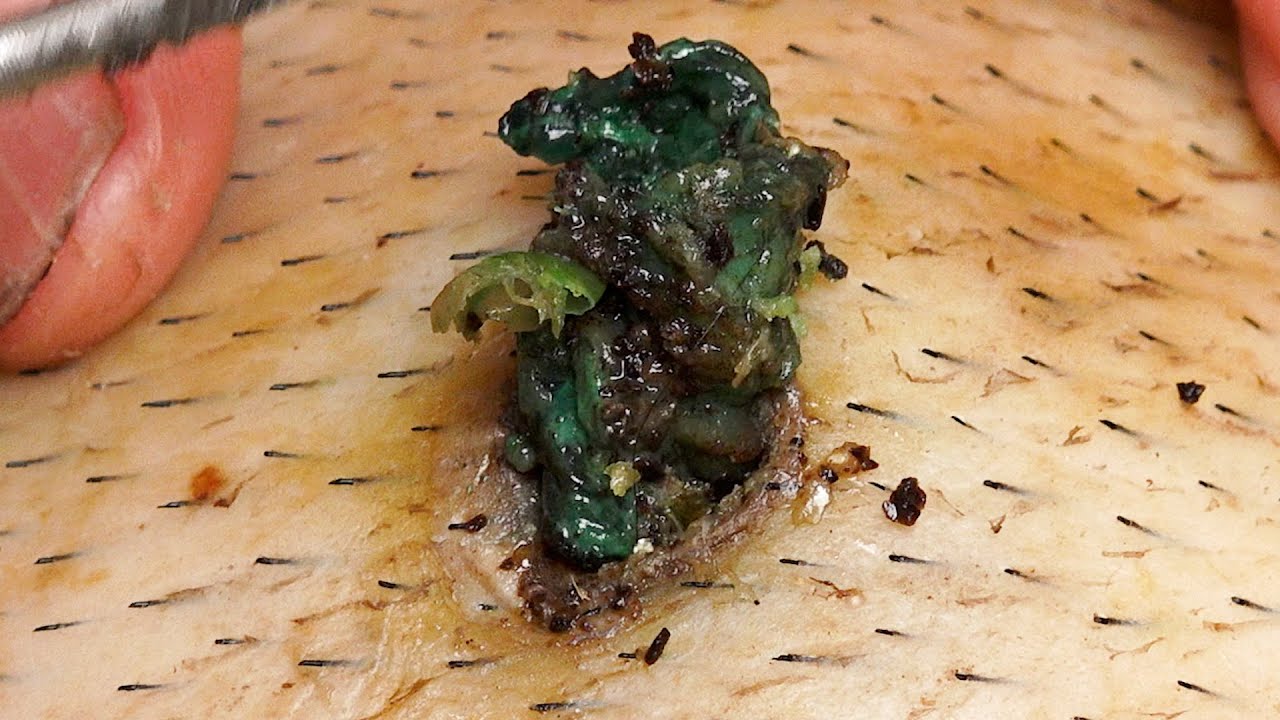 Dr. Lee Geoff Butler Enilsa MrPopZit 🌝 Professional pedicure process 🌝 ...