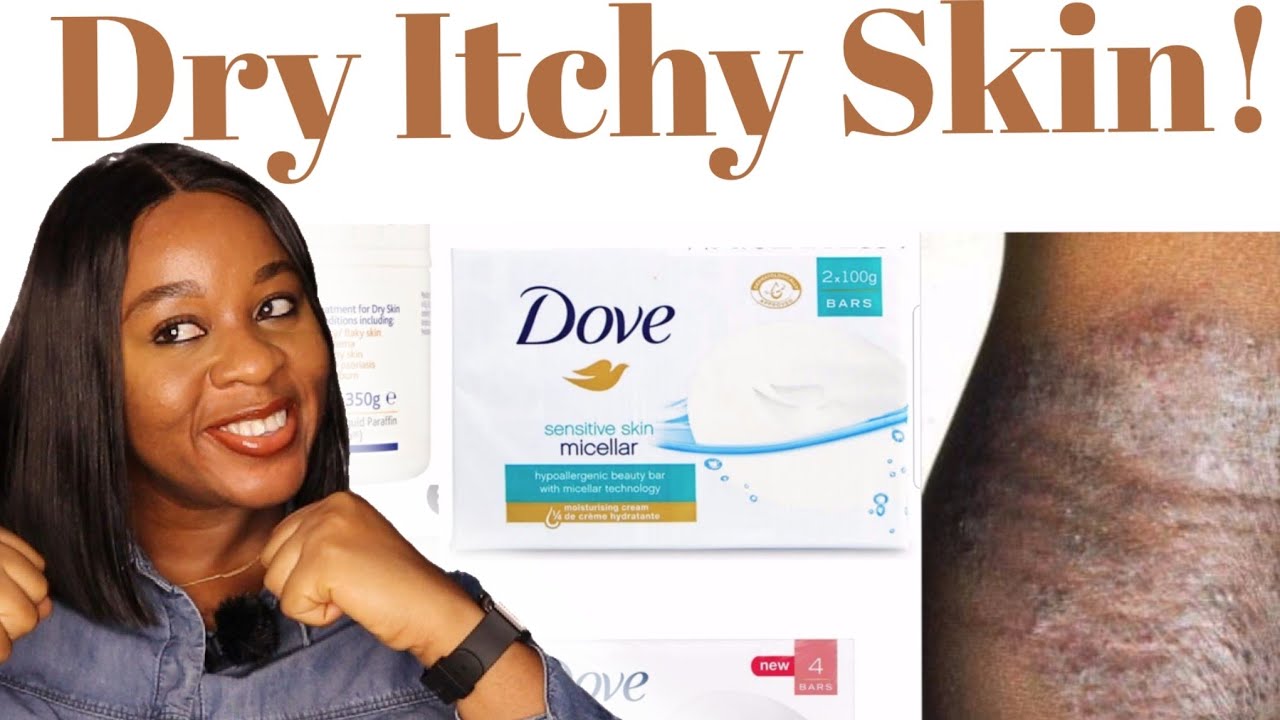 Get Rid of Skin Rashes caused by Dry, Flaky, Itchy Skin using Two ...