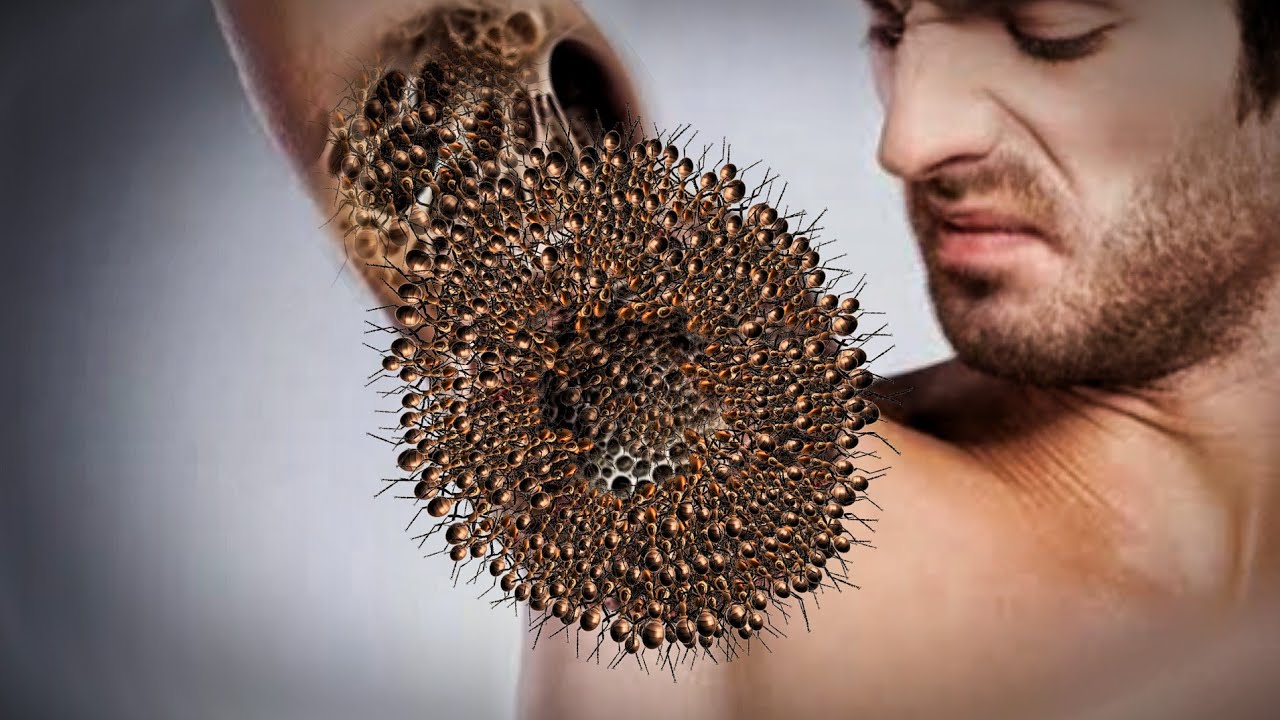 ASMR animation treatment | ASMR infected worm insect infected armpit ...