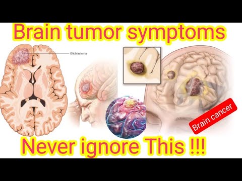 Brain tumor symptoms:10 warning signs of brain tumor that you shouldn't ...