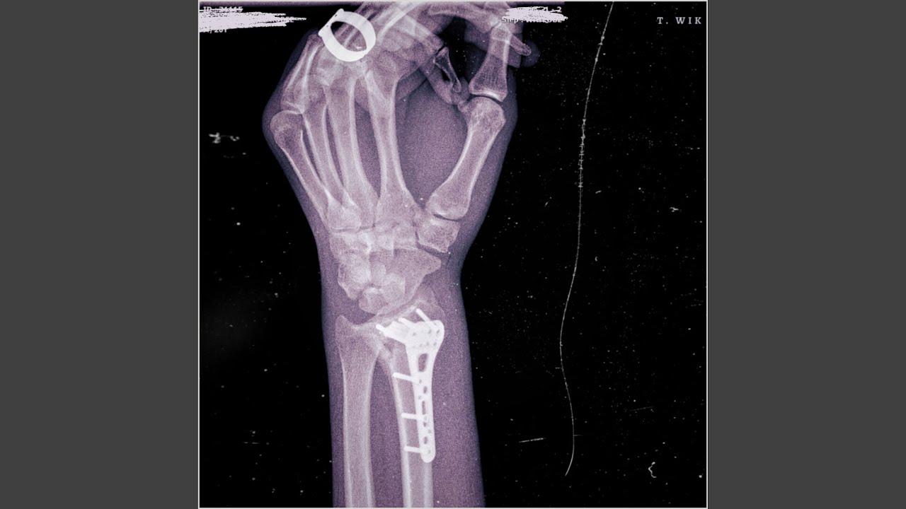 I AM WIDE AWAKE - YouTube