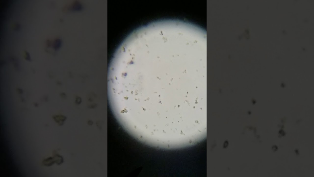 Urinalysis: Manual Microscopic #1 - YouTube