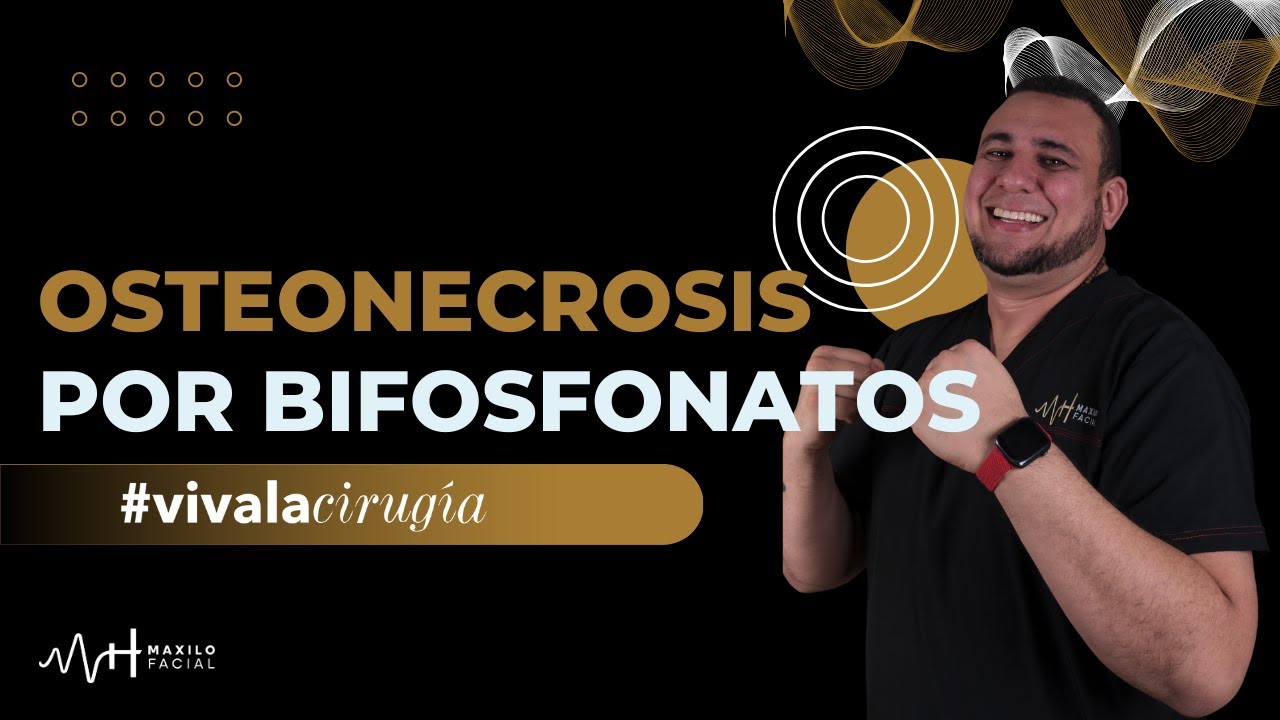 Osteonecrosis por bifosfonatos - YouTube