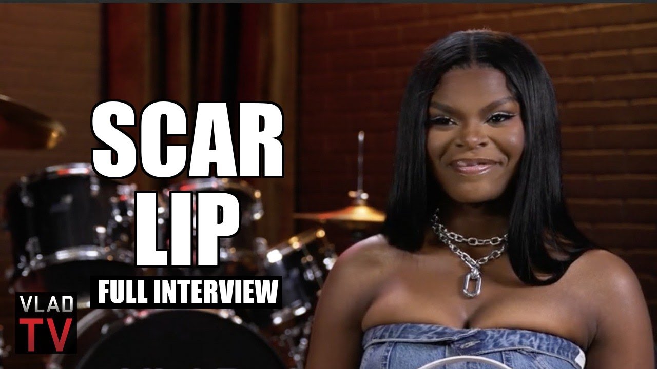 Scar Lip Full Interview YouTube