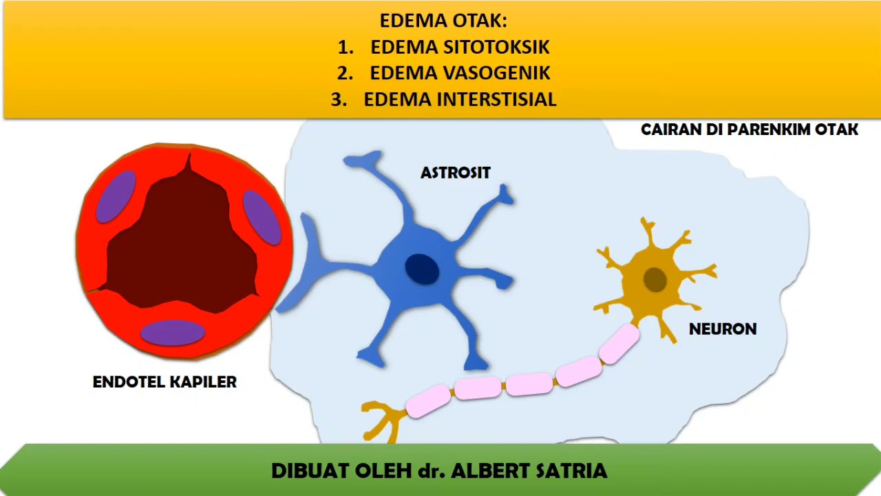 video 72. Jenis Edema Otak - YouTube