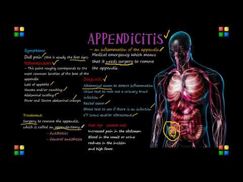 Appendicitis NCLEX Review Nursing Review - YouTube