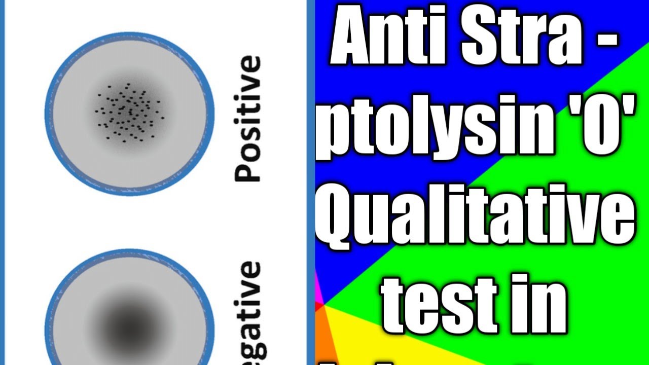 Anti Straptolysin 'O'(ASO) tirte test in hindi || Qualitative test ...