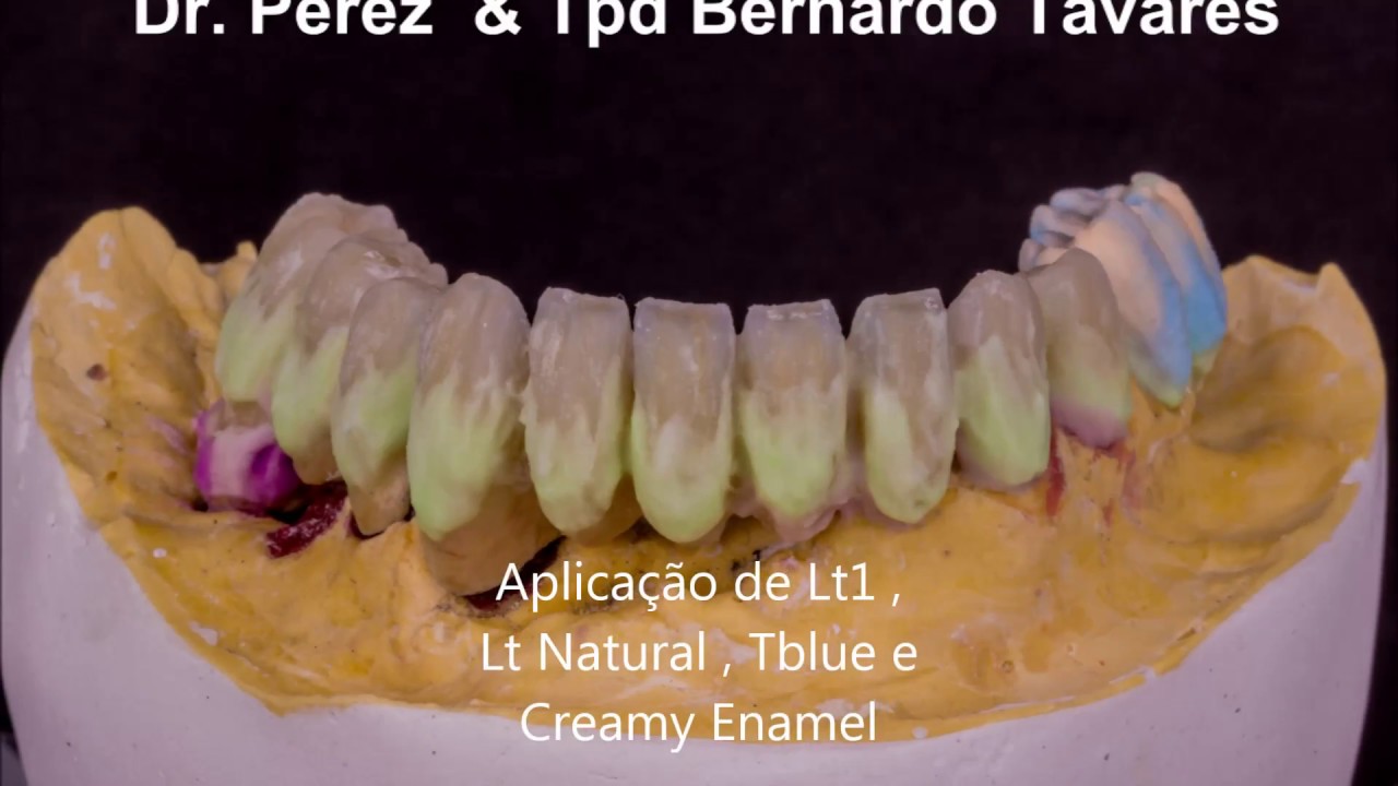 Prótese dentária, aplicação de protocolo cerâmico passo a passo - YouTube