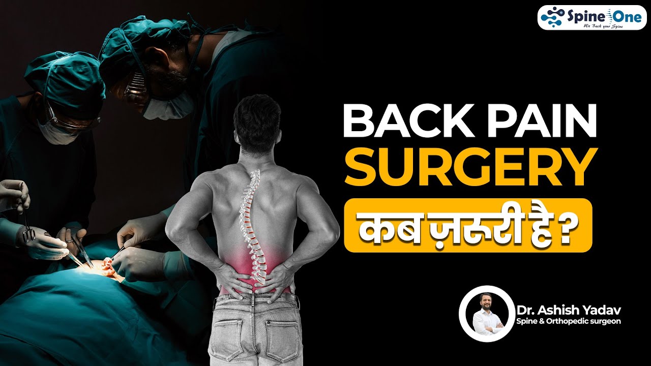 Back Pain Surgery: कब ज़रूरी है? | All About MICROSCOPIC DISCECTOMY # ...