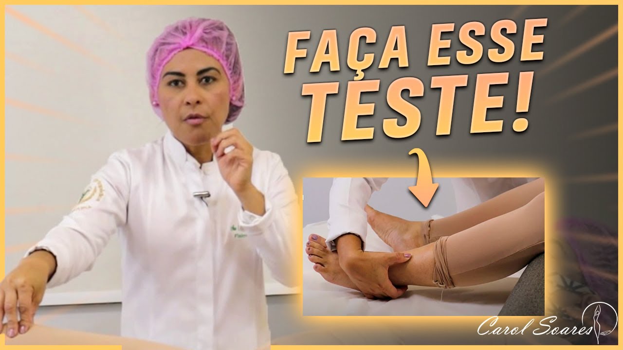 Faça esse teste para saber que tipo de edema sua paciente tem! - YouTube