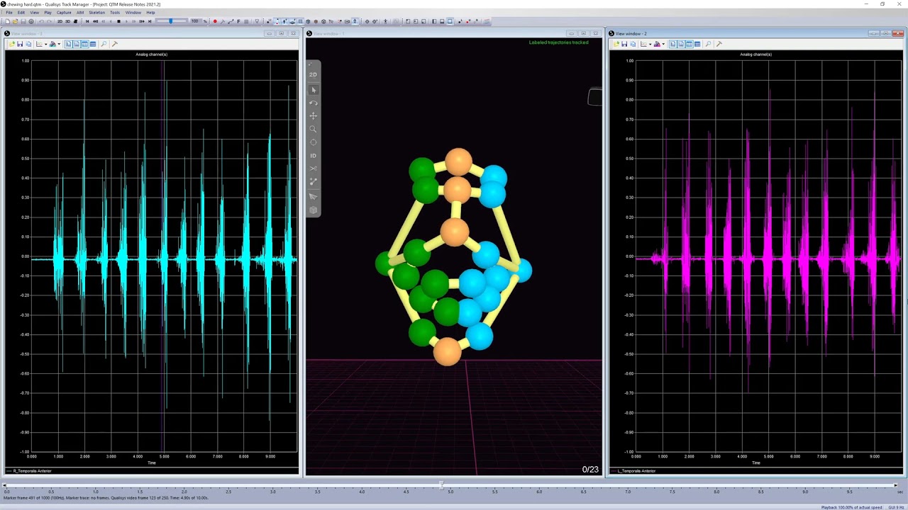 Trigno Integration with QTM 2021.2 - YouTube