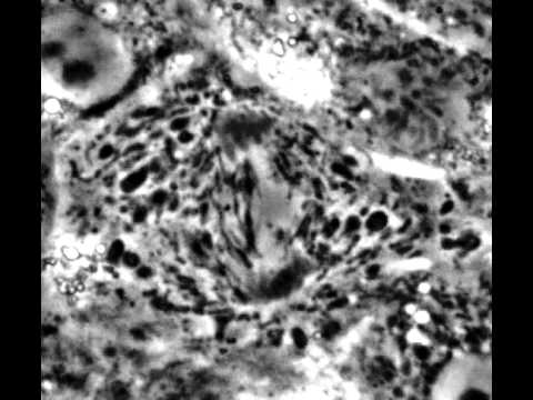 Cell division : Incomplete cytokinesis - YouTube