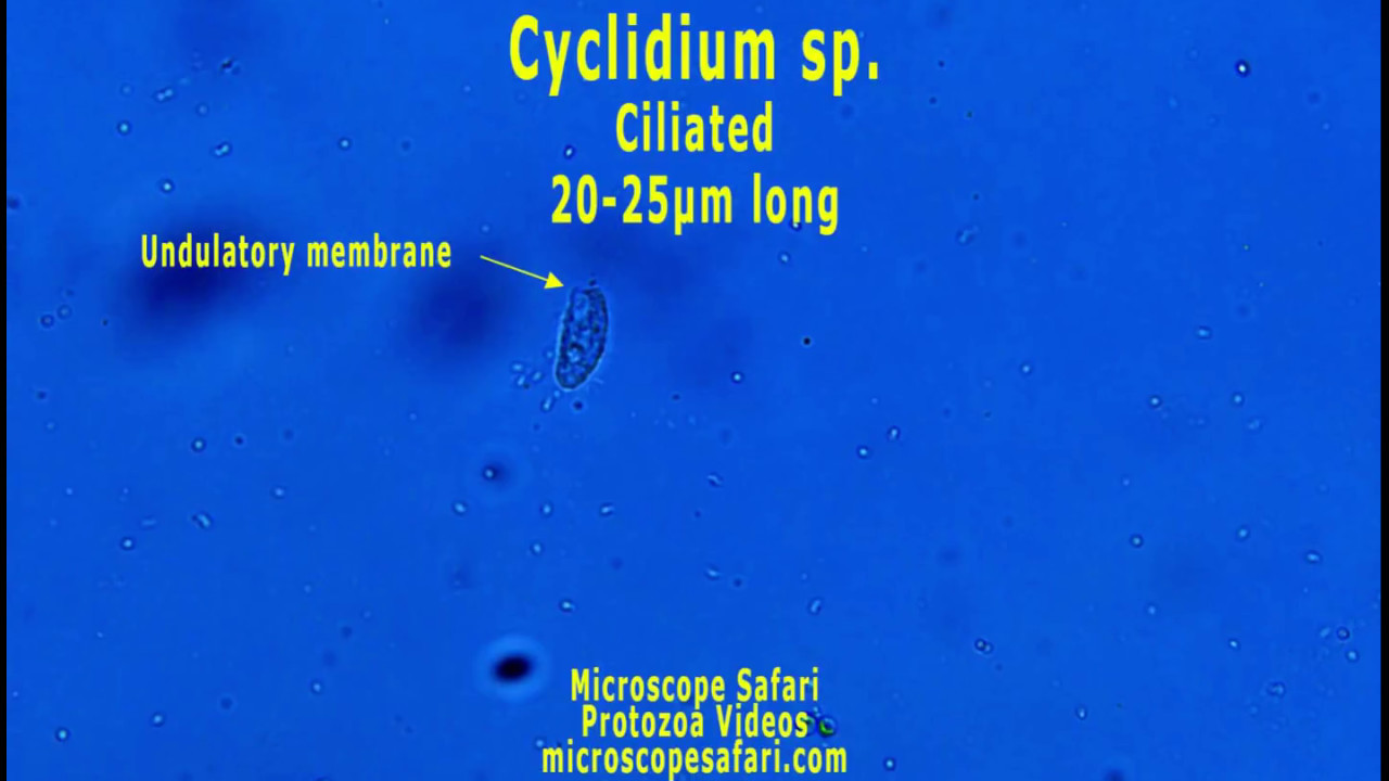 Cyclidium sp. - YouTube
