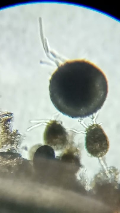 Paracitos bajo el microscopio #music#ciencia - YouTube Paracitos bajo el microscopio #music#ciencia - YouTube