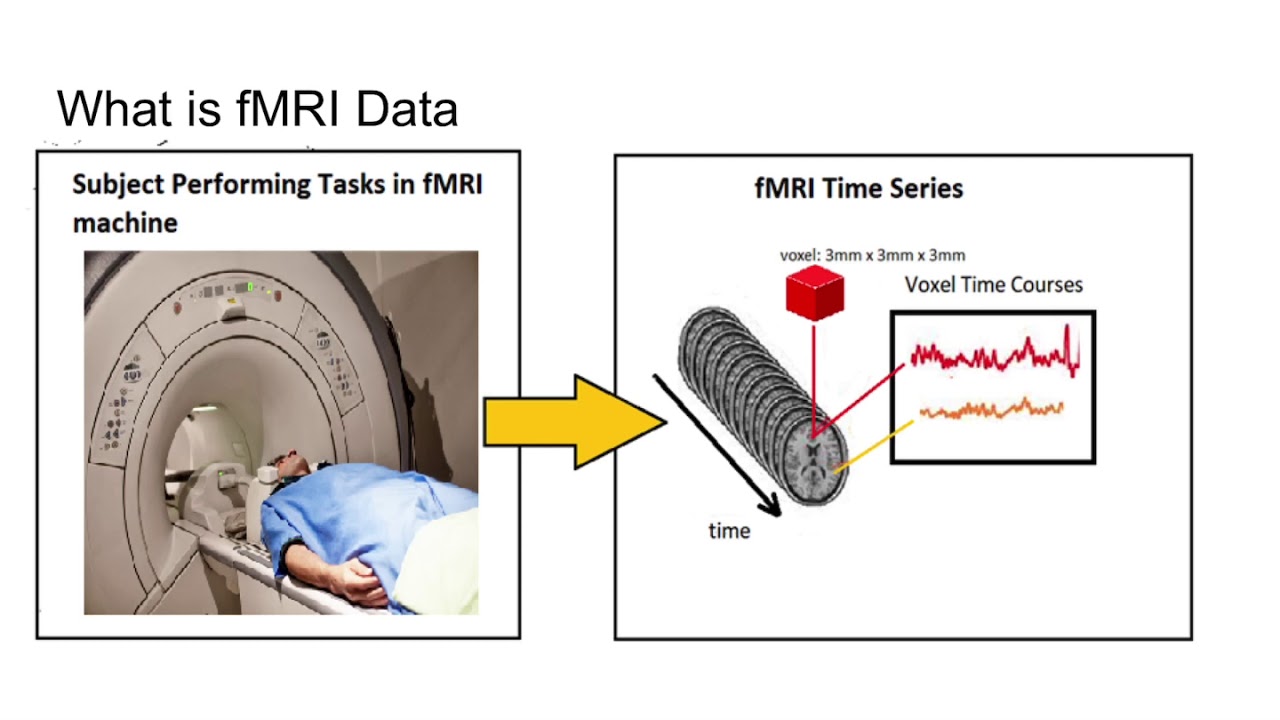 A Comparative Assessment of Statistical Approaches for fMRI Data to ...