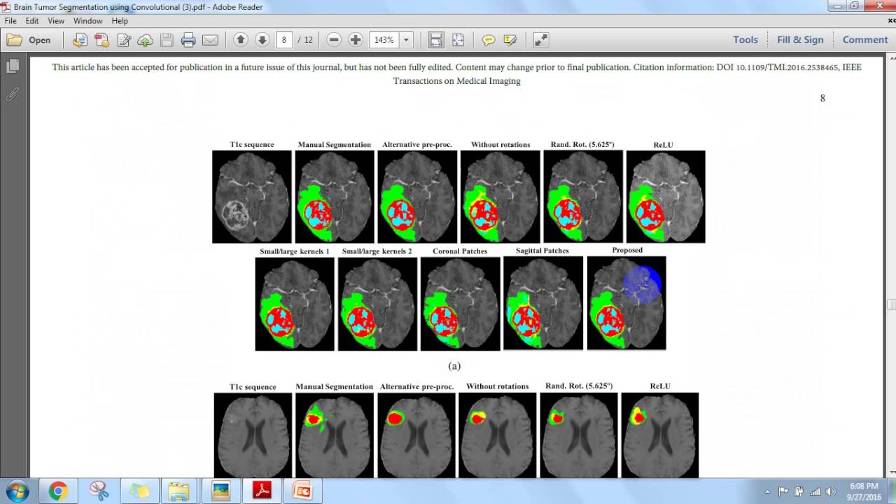 Brain Tumor Segmentation Using Convolutional Neural Networks In Mri Imagesece Projects At