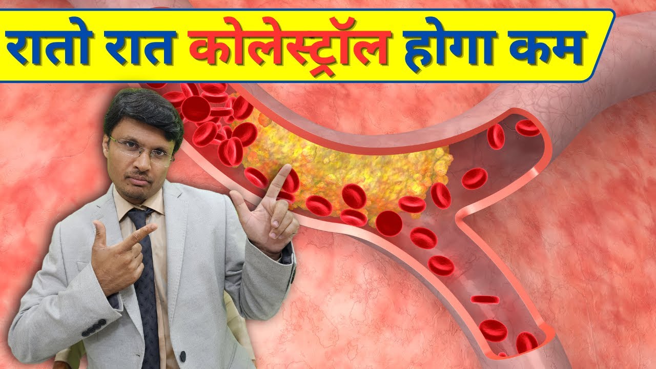The Secret to Lowering Your Cholesterol Levels FAST and EASY - YouTube