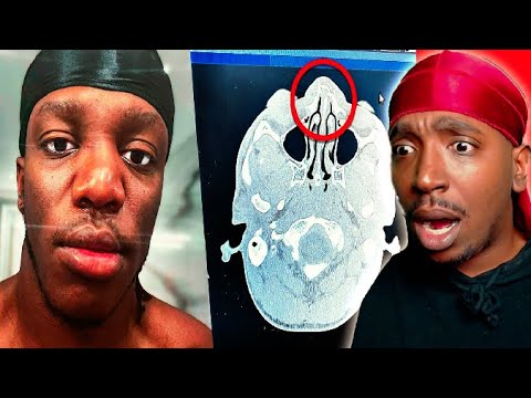Reaction To KSI Nose Break... - YouTube