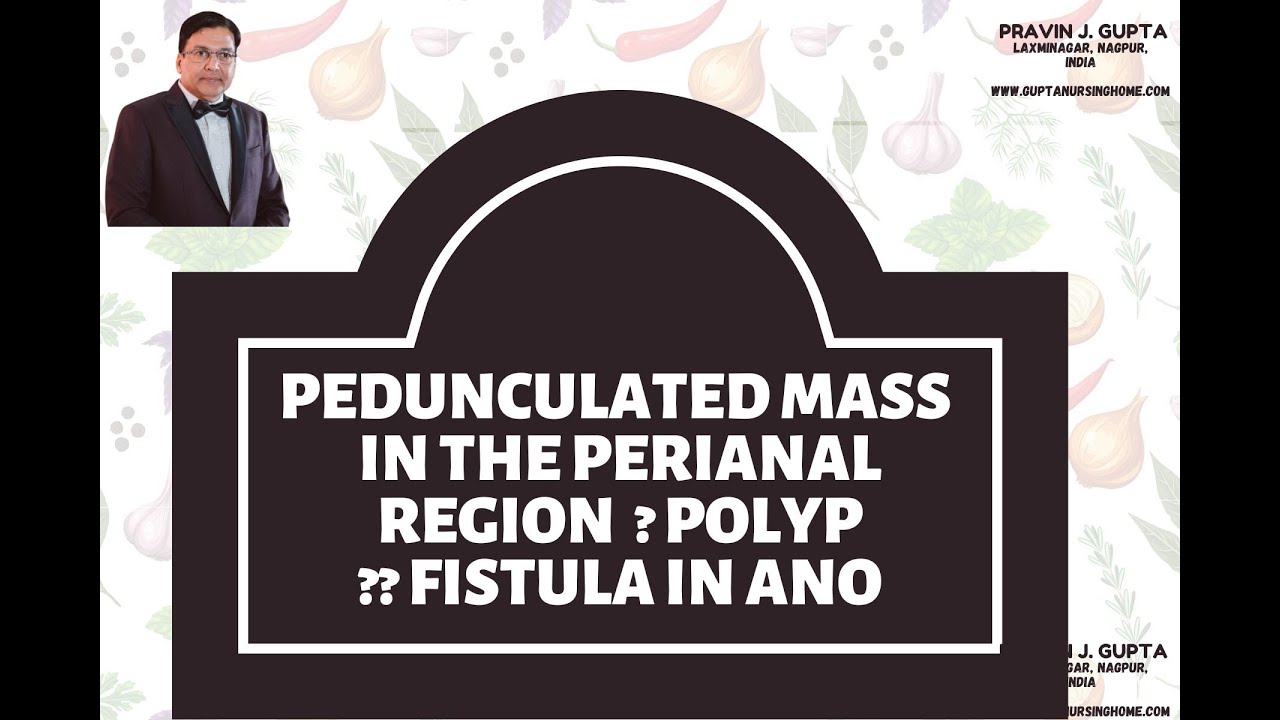 A PEDUNCULATED MASS IN THE PERIANAL REGION ? PAPILLOMA ?? FISTULA - YouTube