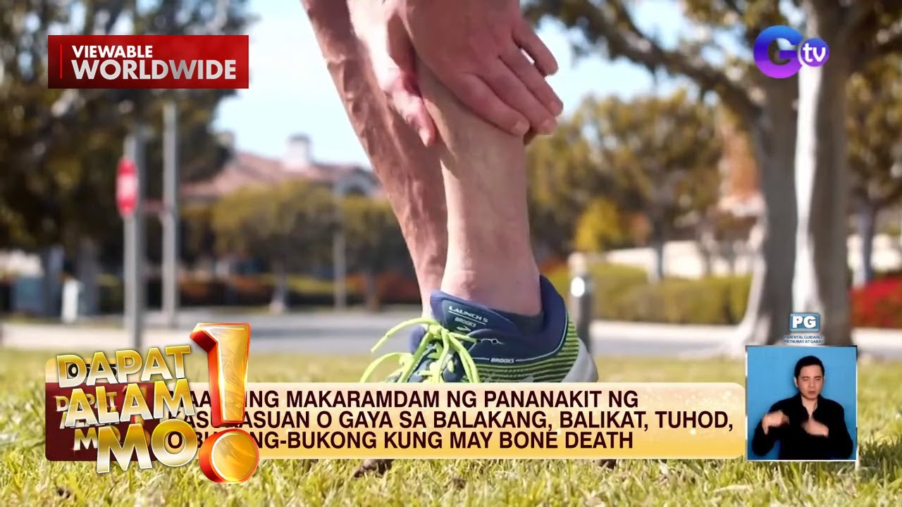 Ano nga ba ang kondisyon na vascular necrosis o “bone death”? | Dapat Alam Mo! - YouTube