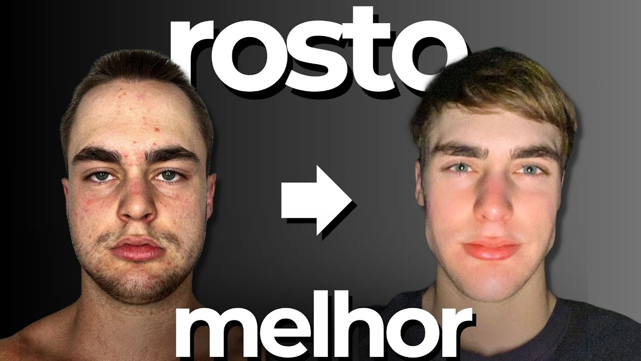 Tenha Rosto e Mandíbula Definida (Sem Mewing) - YouTube