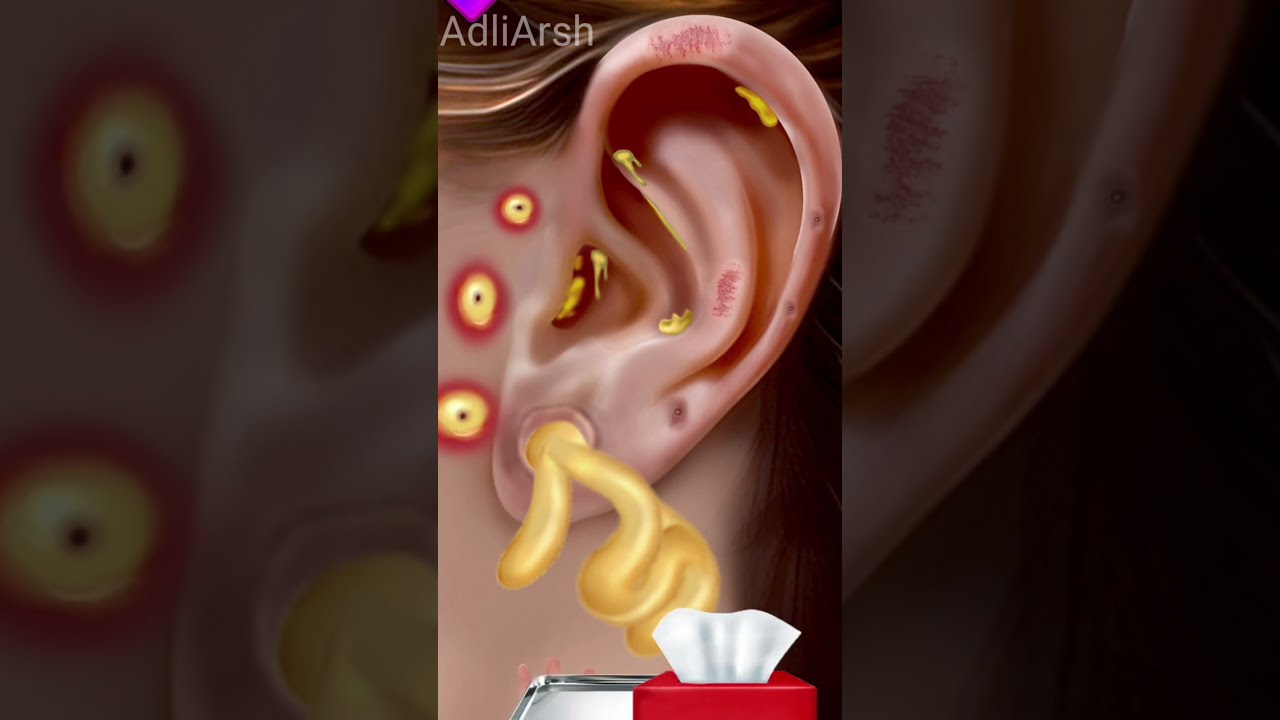 Asmr Ear cleaning treatment | Animation treatment Animation game - YouTube