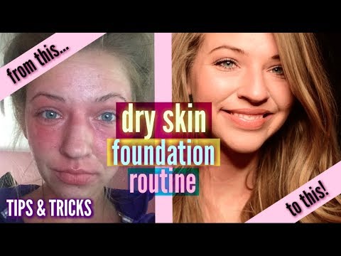 Foundation for DRY Skin, Eczema, RSS, TSW with Skin Care Tips - YouTube