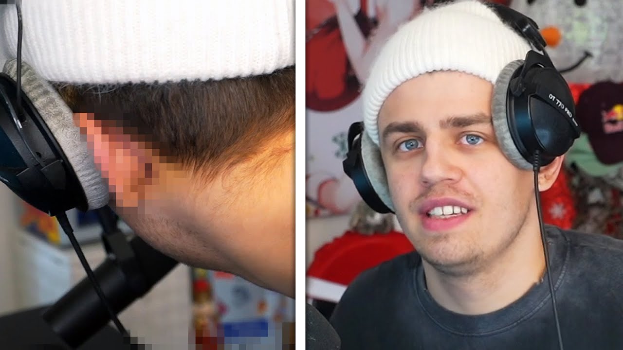 Papaplatte zeigt sein operiertes Ohr - YouTube