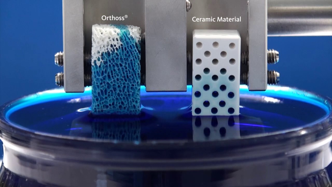 Orthoss Hydro Surgery - YouTube