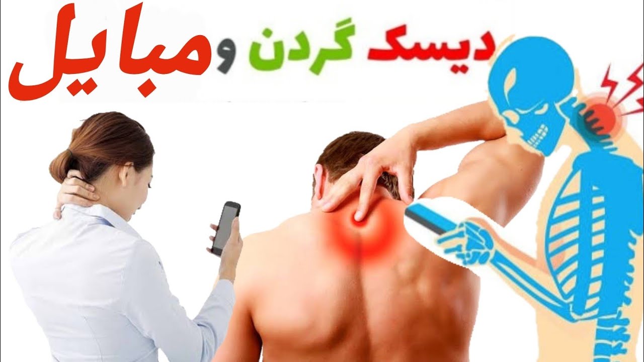 Gamer neck syndrome | سندروم گردن گیم بازان و استفاده غلط از مبایل ...