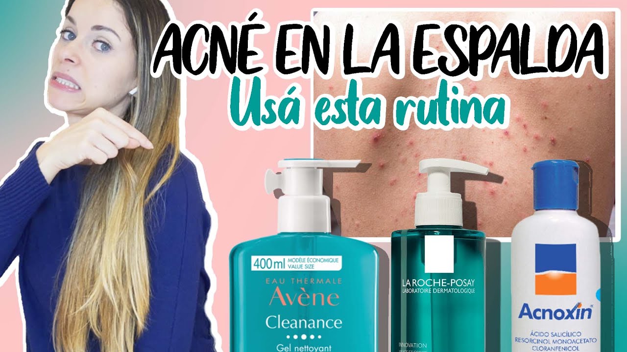 Acné y manchas en la espalda? LA SOLUCIÓN - YouTube