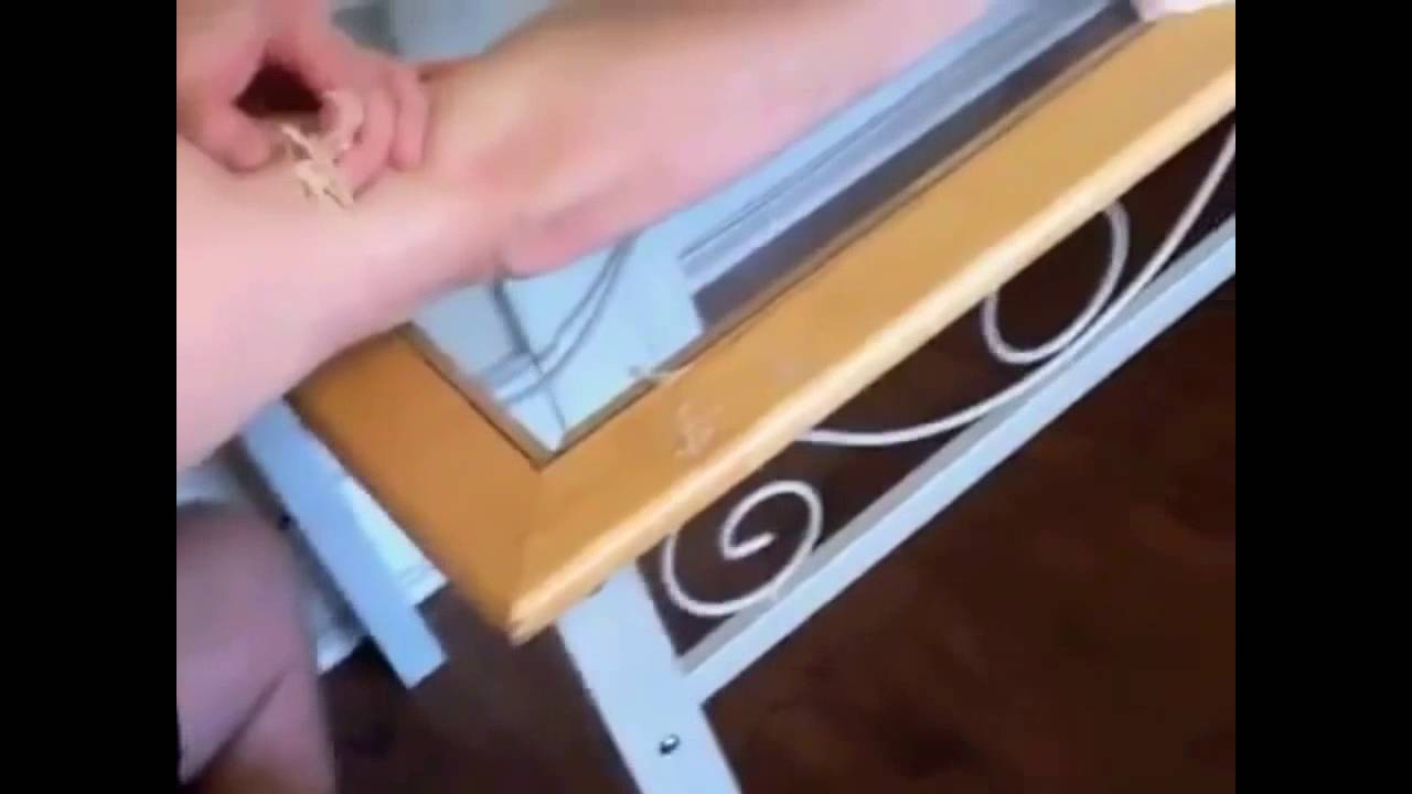 Popping Zits and Cyst & Pimple 2016 - YouTube