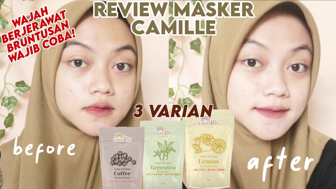 REVIEW BLAK BLAKAN TENTANG MASKER CAMILLE BEAUTY Jerawat bruntusan bisa ...